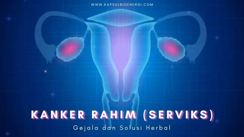 Kanker Rahim (Serviks), Gejala dan Solusi Herbalnya - Kapsul Bioenergi